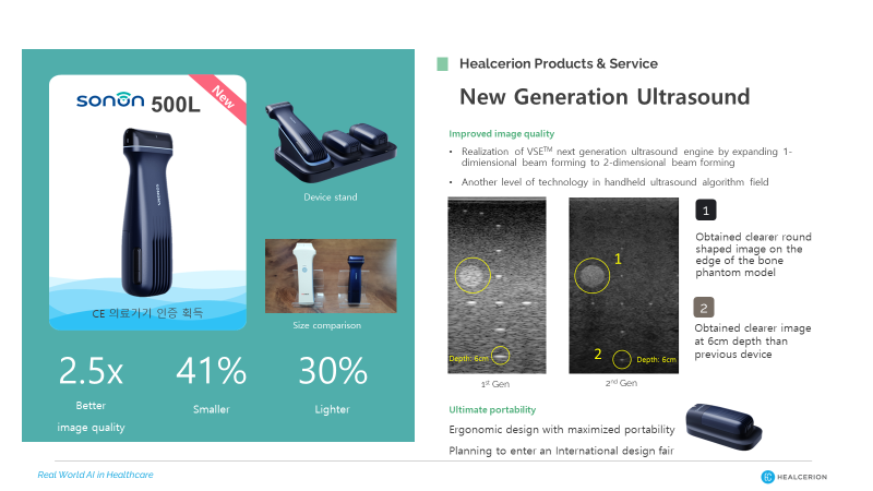 SONON's NEW 500L AND 300C & 300L Upgrades U/S Truly Wireless | Payment Plans To Fit Your Needs ...