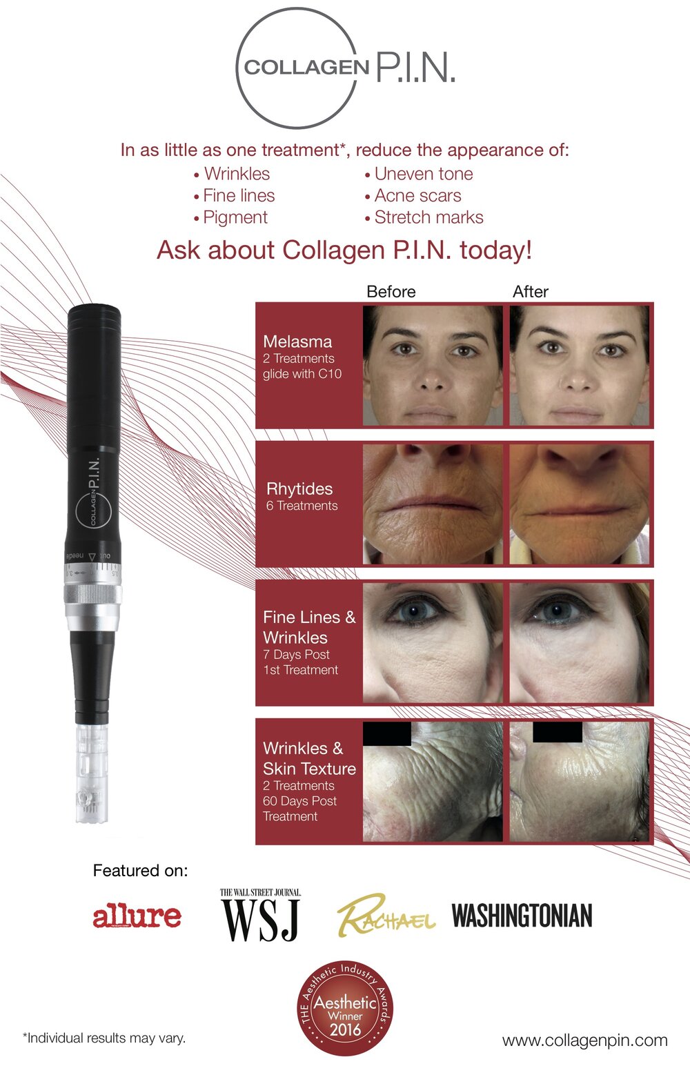 Microneedling by Bare Beauty Aesthetics in Brownsville Area - Alignable